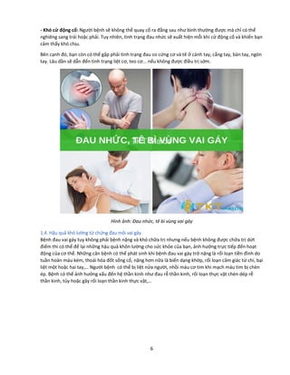 Đau vai gáy văn phòng | PDF