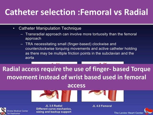 Challenges of Radial Access-Anatomy, Tools and Success | PPT