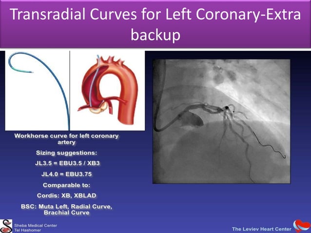 Challenges of Radial Access-Anatomy, Tools and Success | PPT
