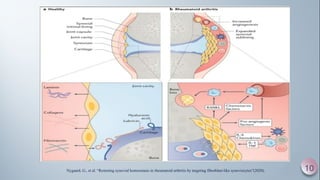 Rheumatoid Arthritis: Pathology, Etiology & Diagnosis (PPT & PDF ...