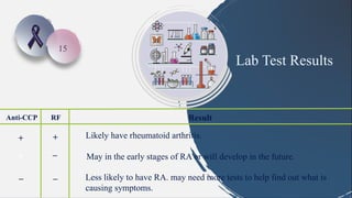 Rheumatoid Arthritis: Pathology, Etiology & Diagnosis (PPT & PDF) | PPTX