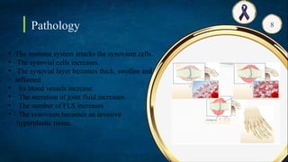 Rheumatoid Arthritis: Pathology, Etiology & Diagnosis (PPT & PDF) | PPTX