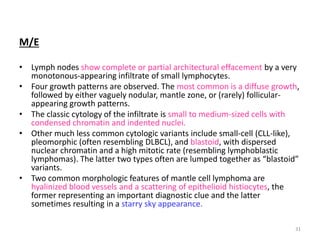 Non hodgkin lymphoma | PPTX