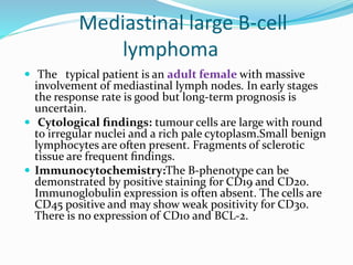 Non Hodgkin Lymphoma, cytology. | PPTX