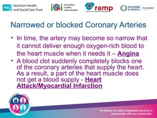 NHSCT-Angina-Powerpoint (2).potx CARDIAC SURGERY | POTX