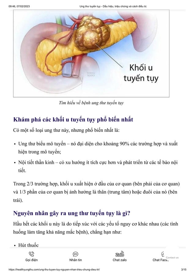 Nhung dieu can biet ve ung thu tuyen tuy.pdf
