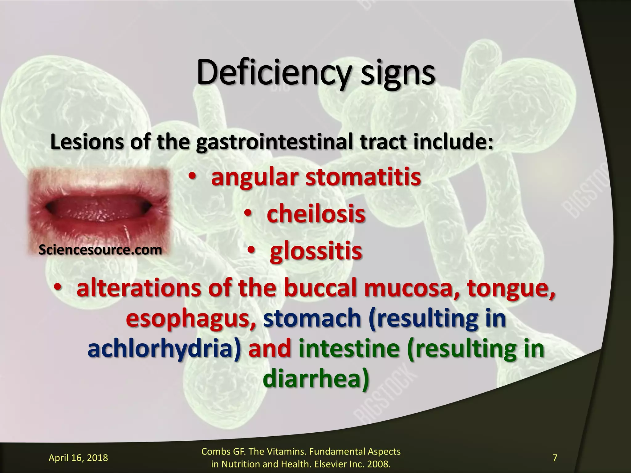 Niacin deficiency and toxicity | PPSX