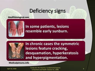 Niacin deficiency and toxicity | PPT