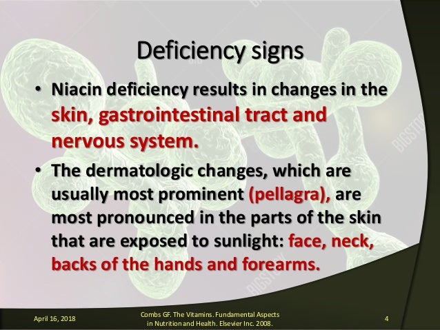Niacin deficiency and toxicity