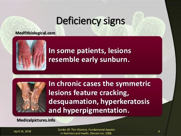 Niacin deficiency and toxicity