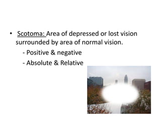 Visual field defects | PPTX