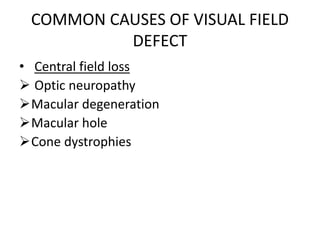 Visual field defects | PPTX