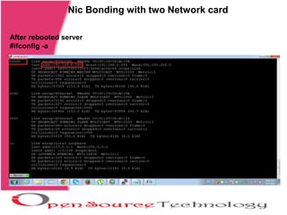 Nic bonding | PPT