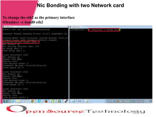 Nic bonding | PPT