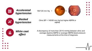 NICE guidelines on Hypertension: Diagnosis and management | PPTX