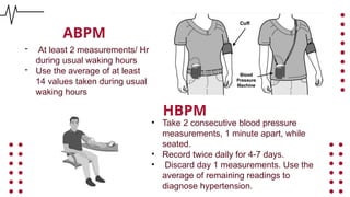 NICE guidelines on Hypertension: Diagnosis and management | PPTX