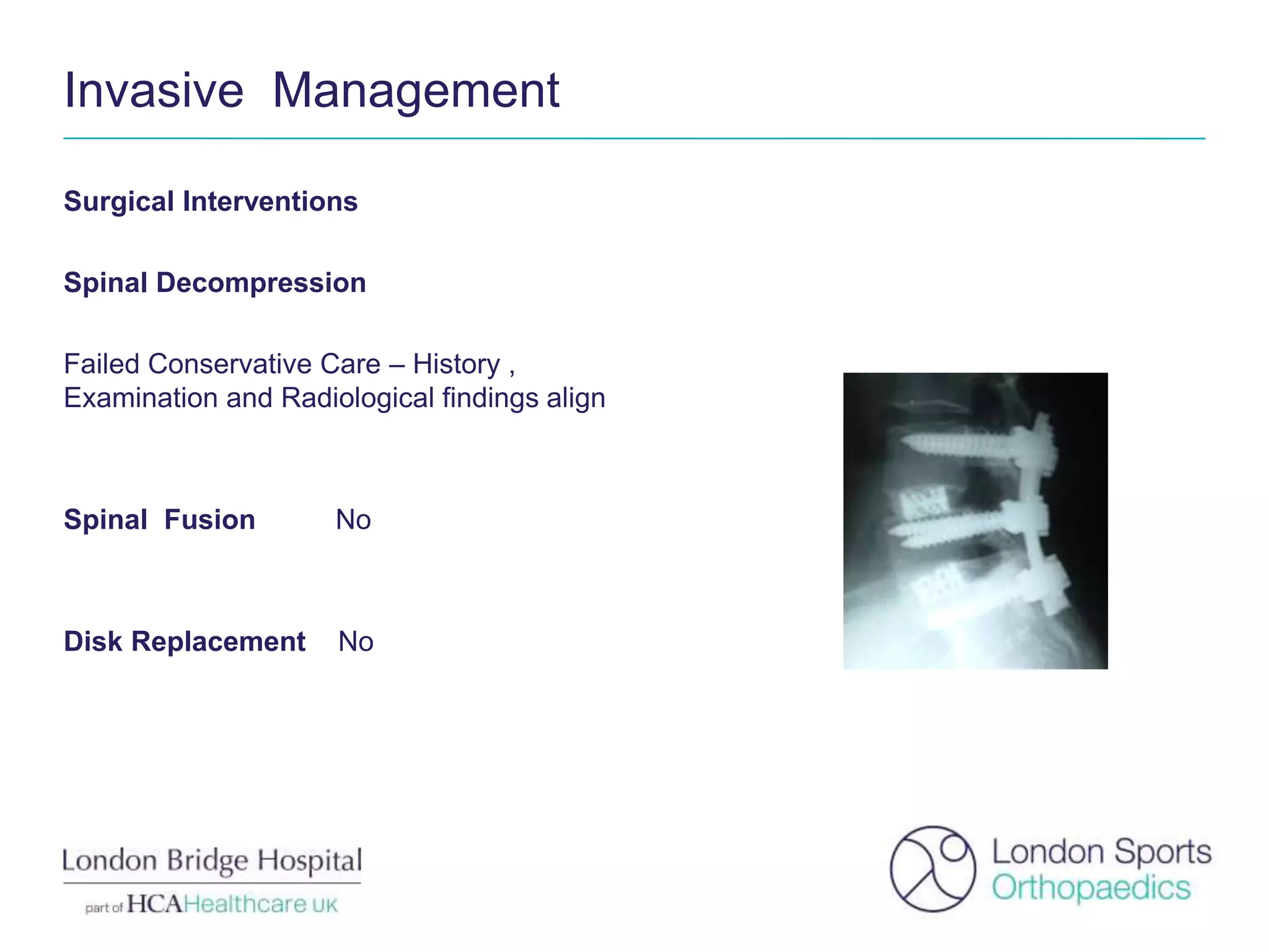 NICE Guidelines for Low Back Pain & Sciatica - A Useful Tool or a NHS ...