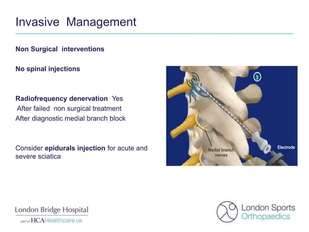 NICE Guidelines for Low Back Pain & Sciatica - A Useful Tool or a NHS ...