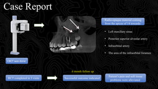 Nicolau Syndrome in Endodontics - Endodontic Emergency | PPTX