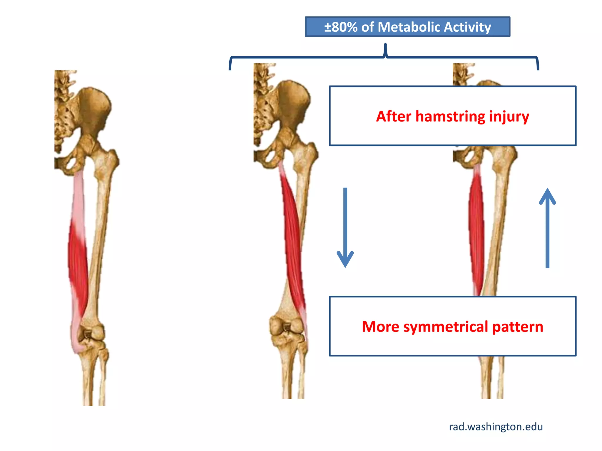 Hamstring strength, training sweet spot and shared decision making ...
