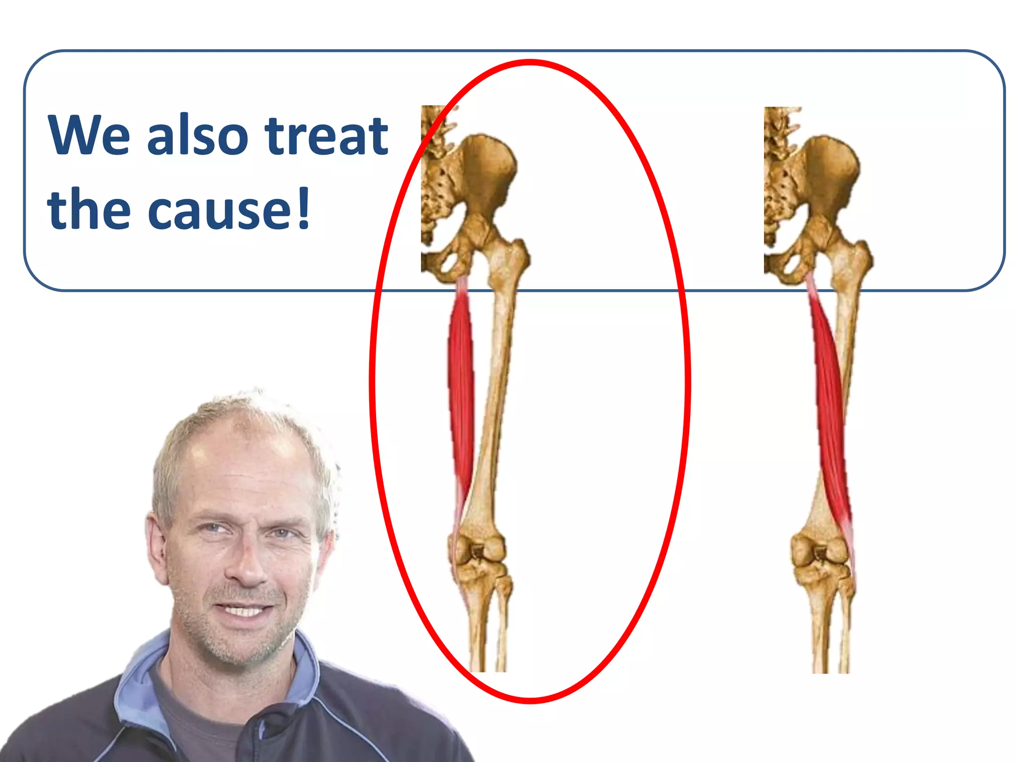Hamstring strength, training sweet spot and shared decision making ...