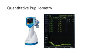 Non-invasive Intracranial Pressure Monitoring for Neurosurgeons | PPT
