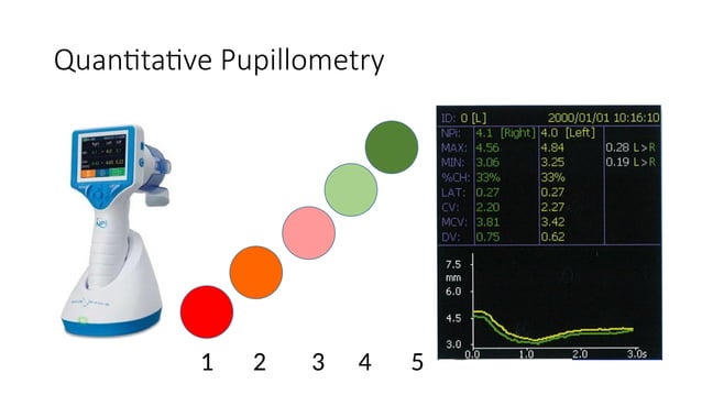 Non-invasive Intracranial Pressure Monitoring for Neurosurgeons | PPT
