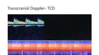 Non-Invasive ICP Monitoring for Neurosurgeons | PPT