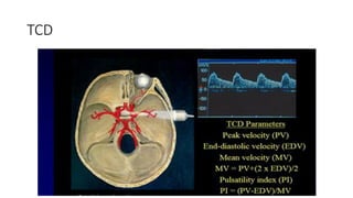 Non-Invasive ICP Monitoring for Neurosurgeons | PPT