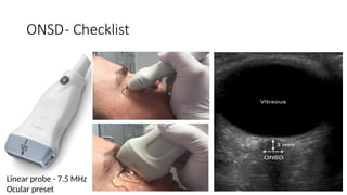 Non-Invasive ICP Monitoring for Neurosurgeons | PPT