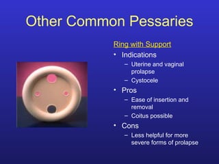Dr. Kay Daniel's Pessary Presentation (English) | PPT