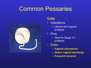 Dr. Kay Daniel's Pessary Presentation (English) | PPT