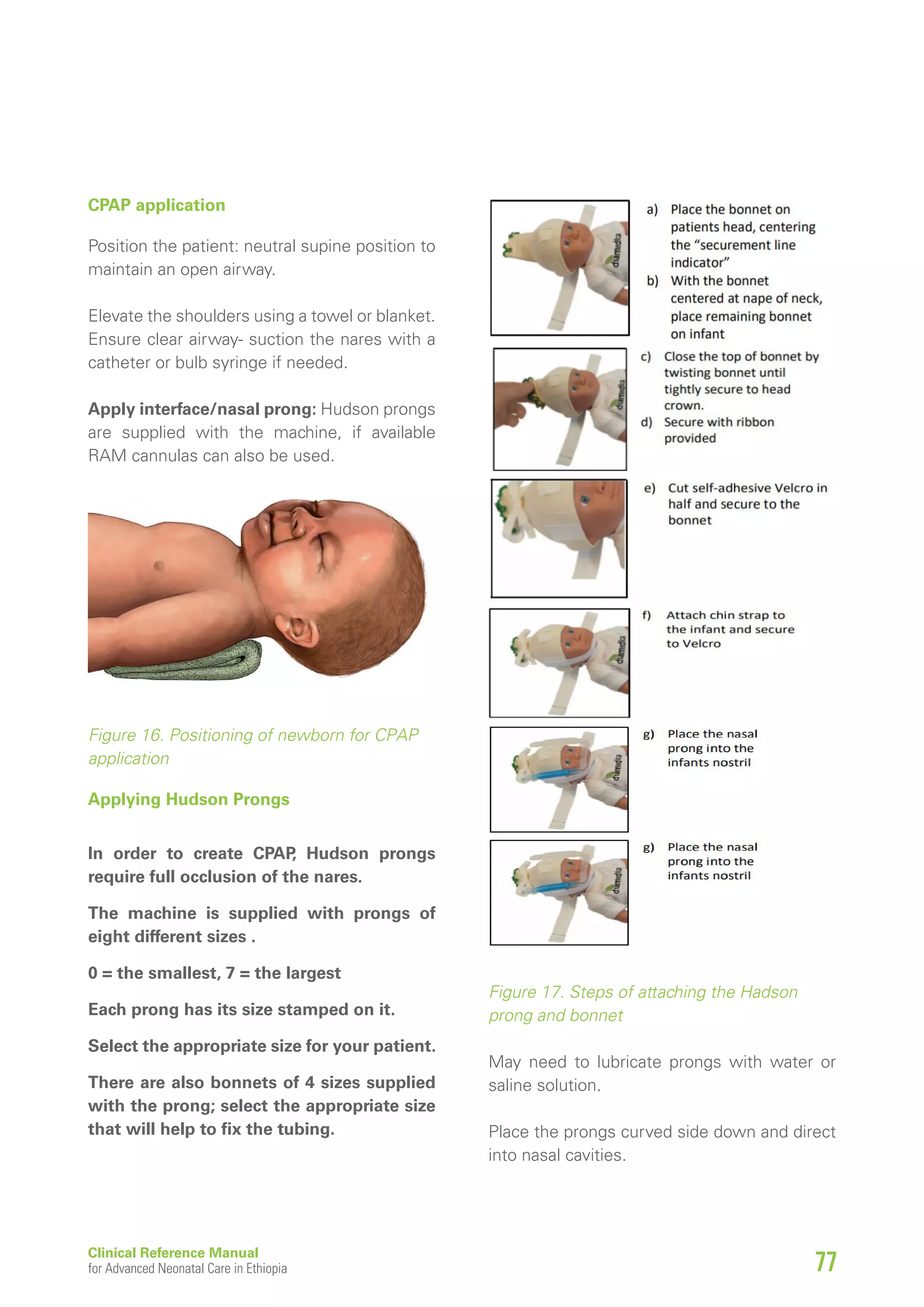 Nicu 2021 Ethiopia | PDF