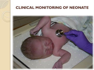 NICU AND PROTOCOL FOR NURSING STUDENTS STUDY | PPTX