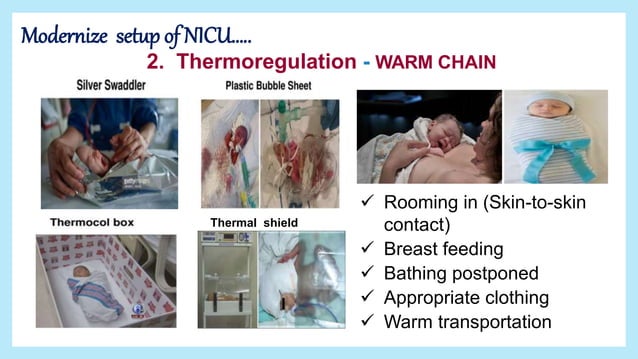 Modernize Setup Of NICU And PICU | PPTX | Parenting Babies and Toddlers ...