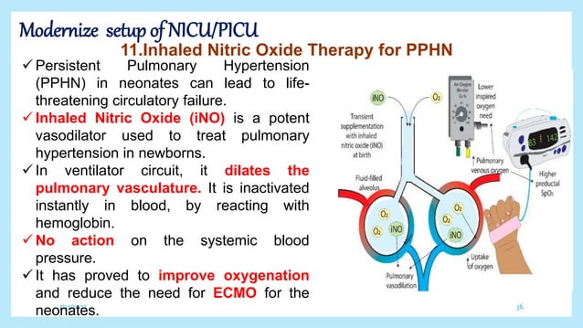 Modernize Setup Of NICU And PICU | PPTX | Parenting Babies and Toddlers ...