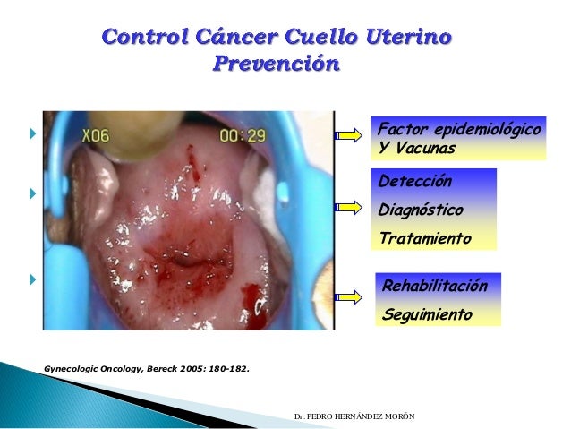 Cáncer De Cuello Uterino Y Nic Screening Ene 2011