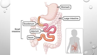motility disorders in pediatrics advances | PPTX