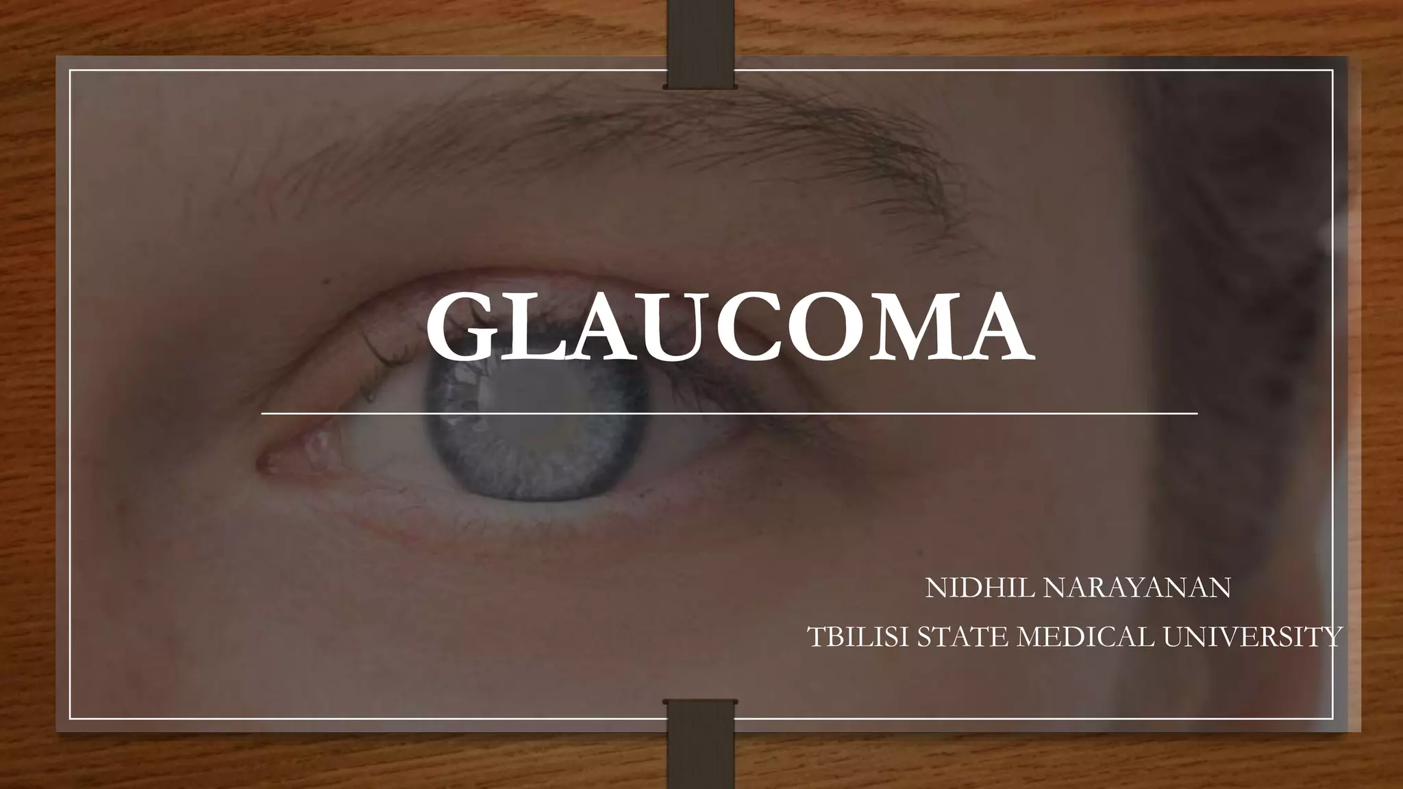 GLAUCOMA | PPTX