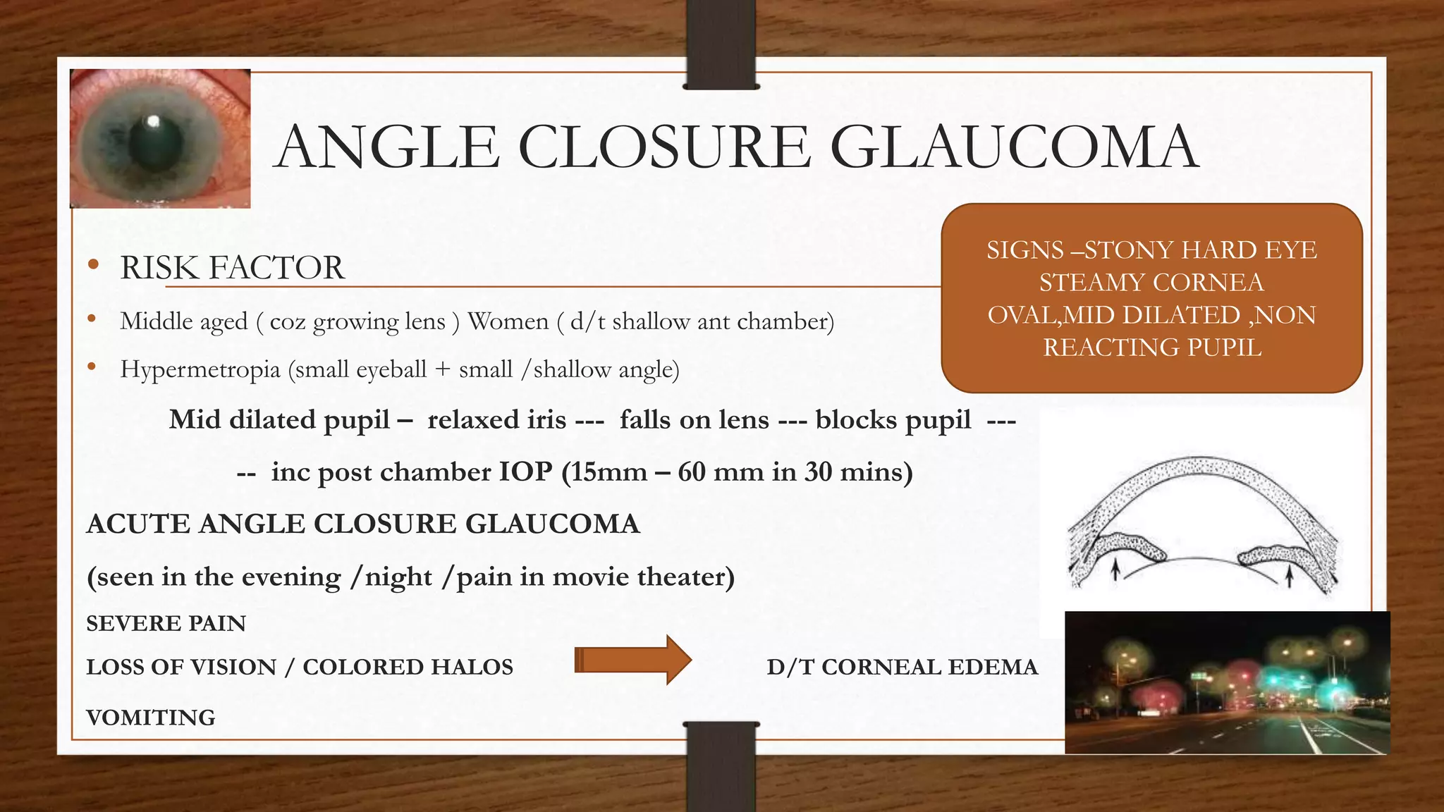 GLAUCOMA | PPTX