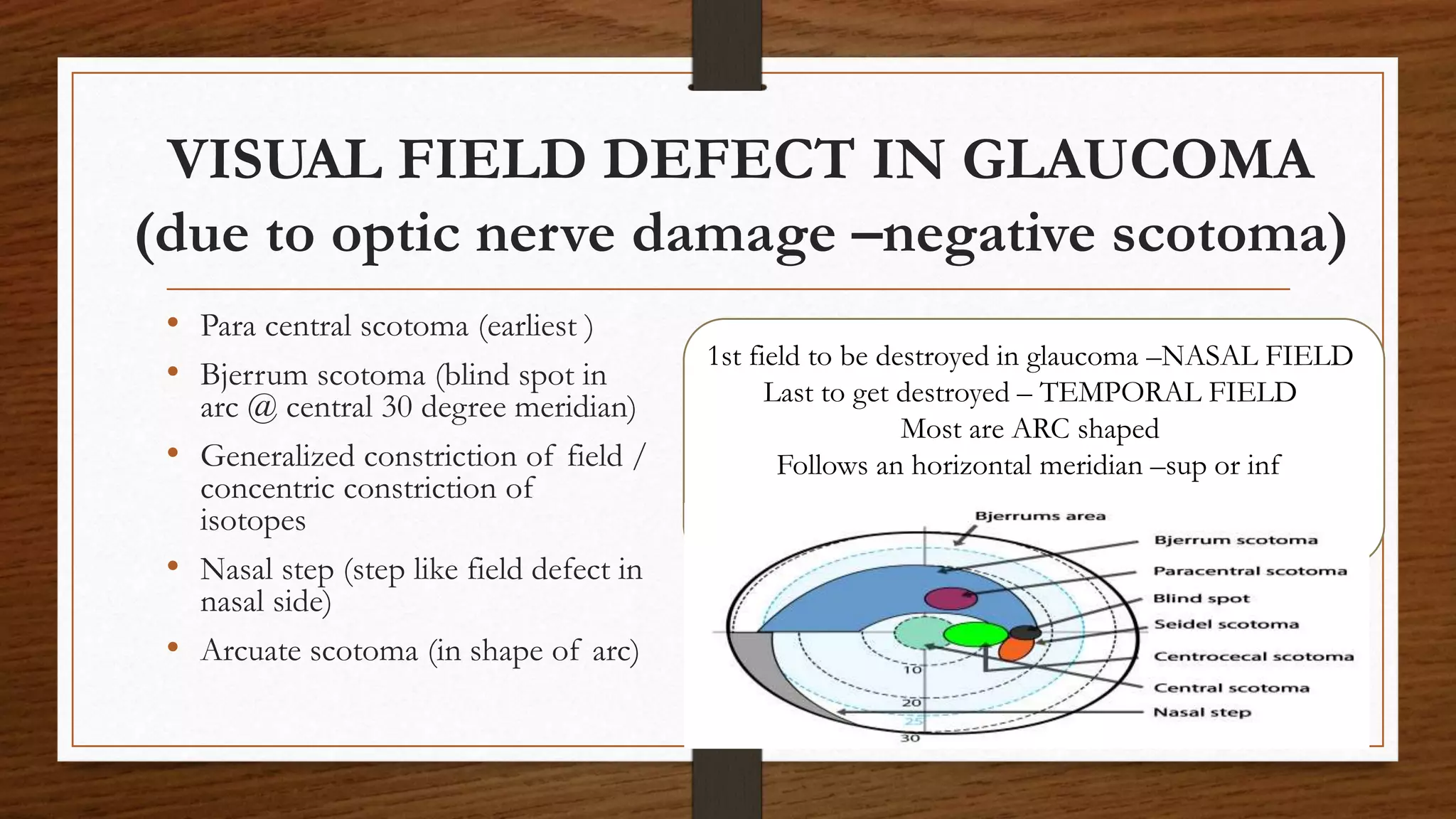 GLAUCOMA | PPTX