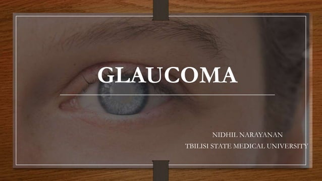 GLAUCOMA | PPT