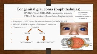 GLAUCOMA | PPTX