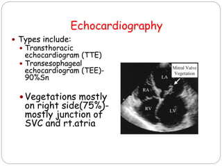 NEONATAL ENDOCARDITIS | PPTX