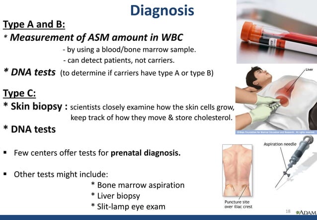 Niemann Pick Disease (Nafisa Nawal Islam) | PPTX | Genetics | Science