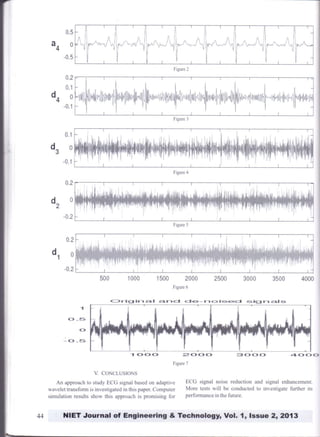 ECG Signal Enhancement Using Wavelet Transform | PDF