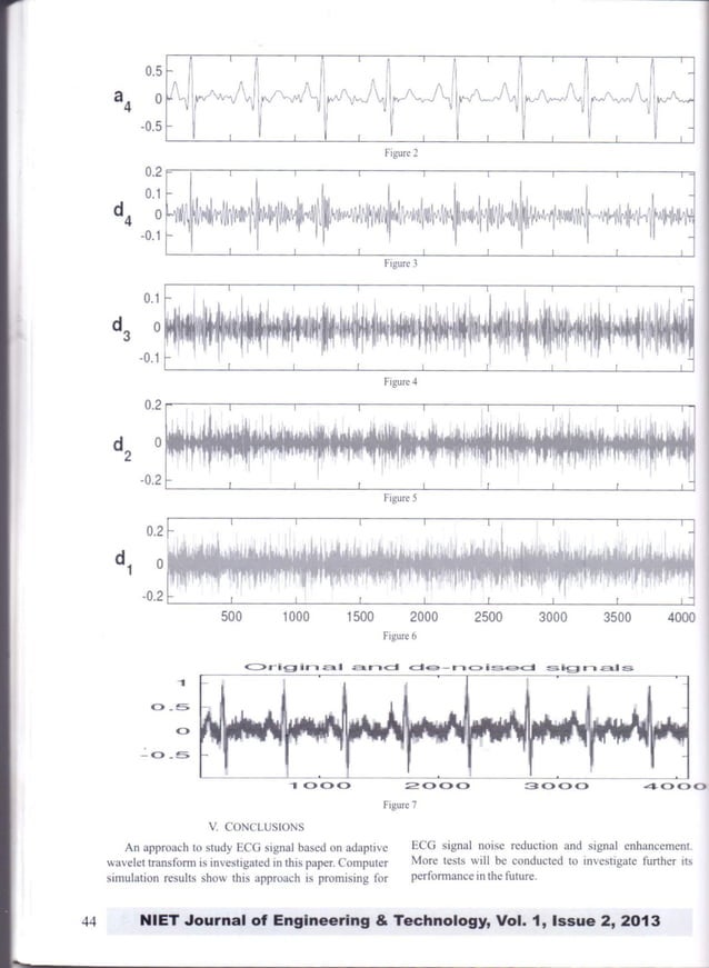 ECG Signal Enhancement Using Wavelet Transform | PDF