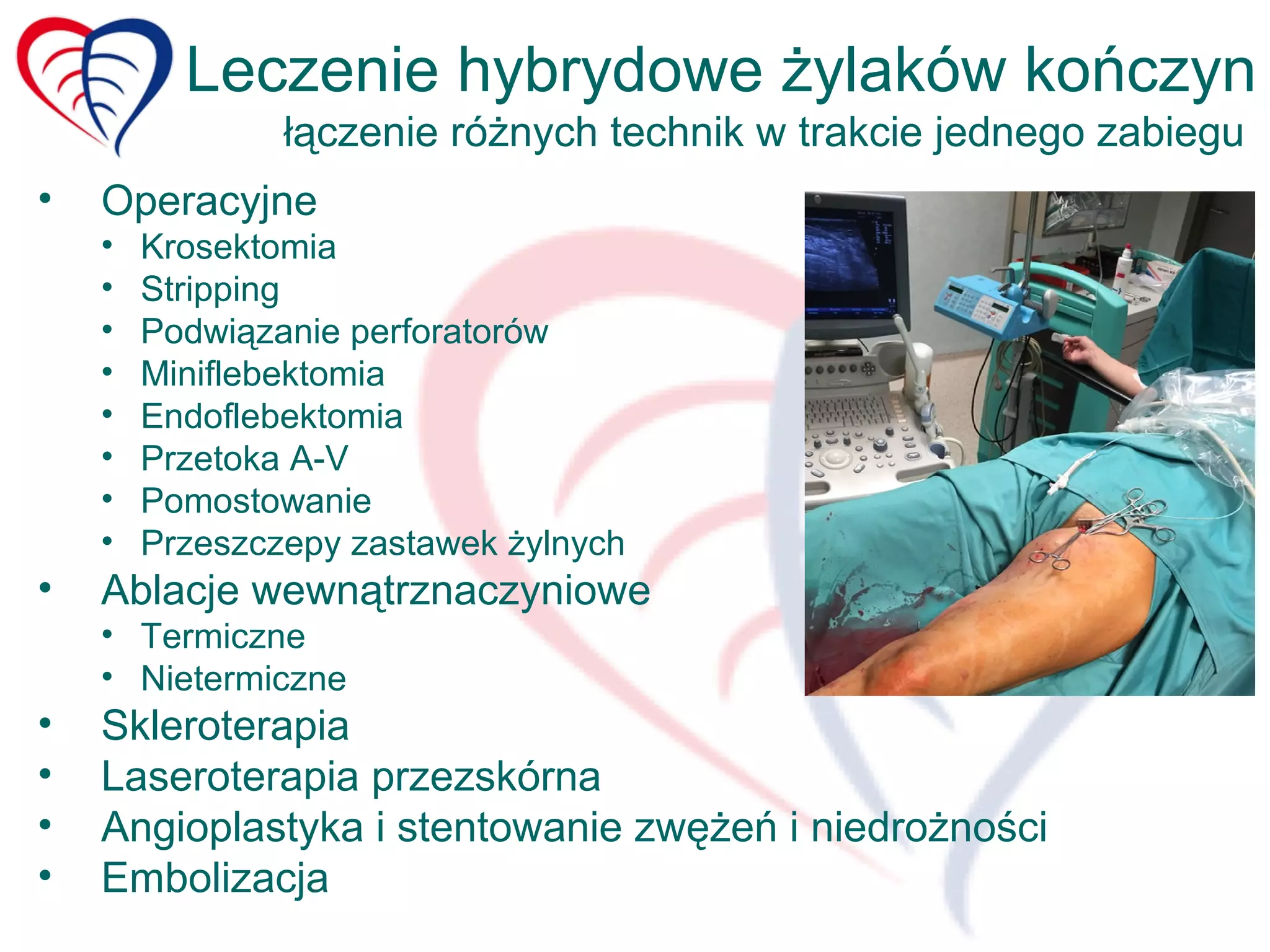 Nietypowe żylaki kończyn dolnych | PPT | Physical Therapy | Wellness