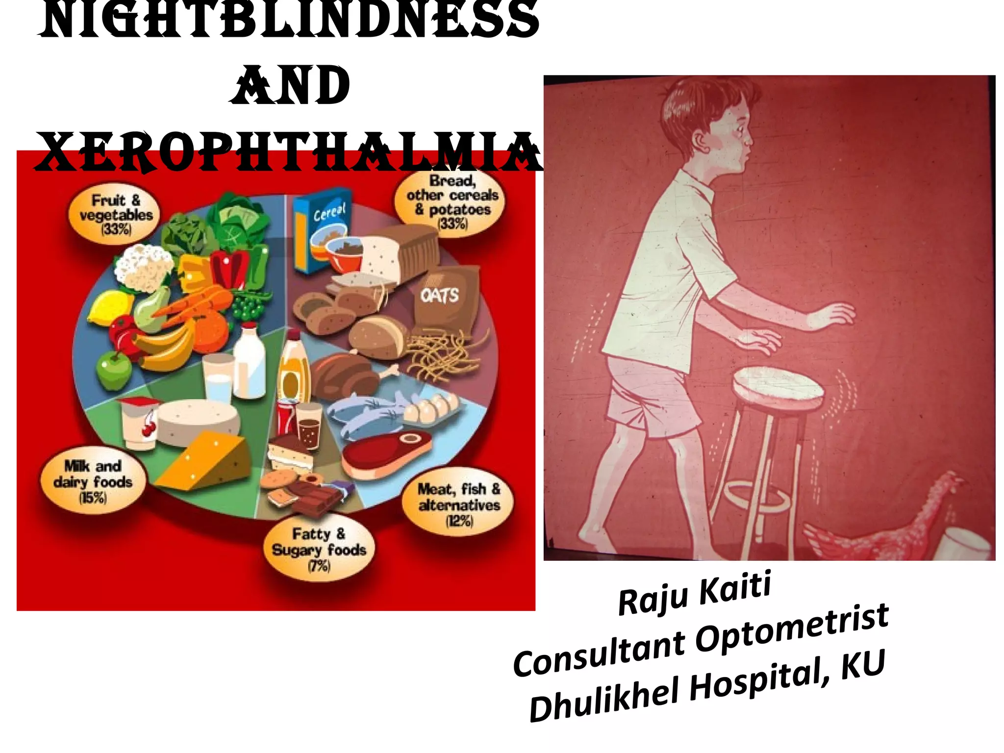 Nightblindness and xerophthalmia | PPT