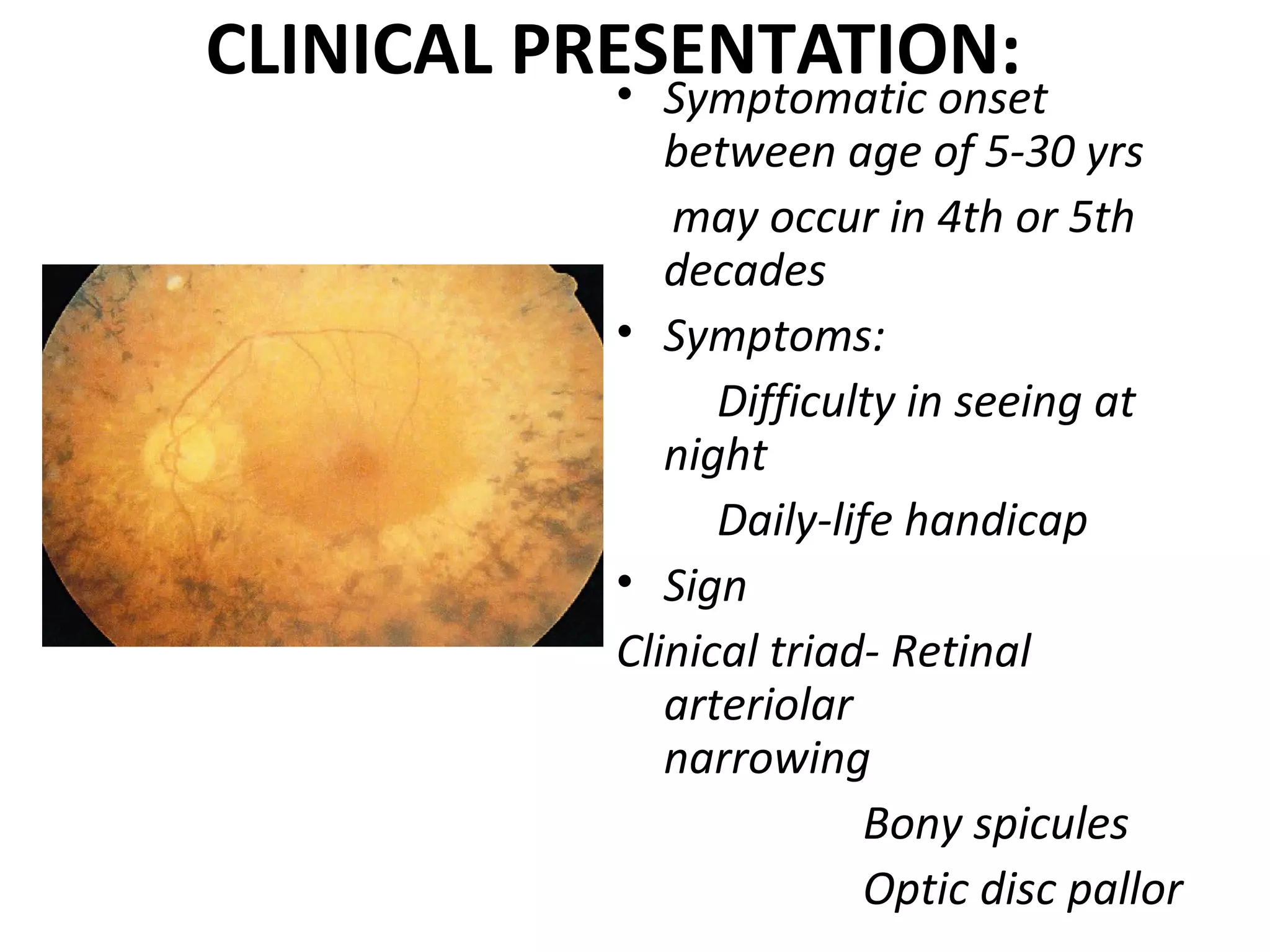 Nightblindness and xerophthalmia | PPT